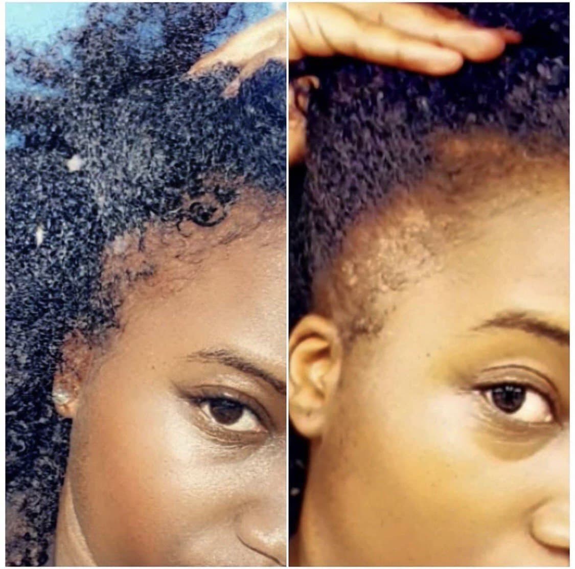 Hair-1 – My Blog